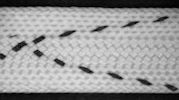 Polyethylene braid, UHMWPE suture, UHMWPE tape, suture tape, orthopedic ...